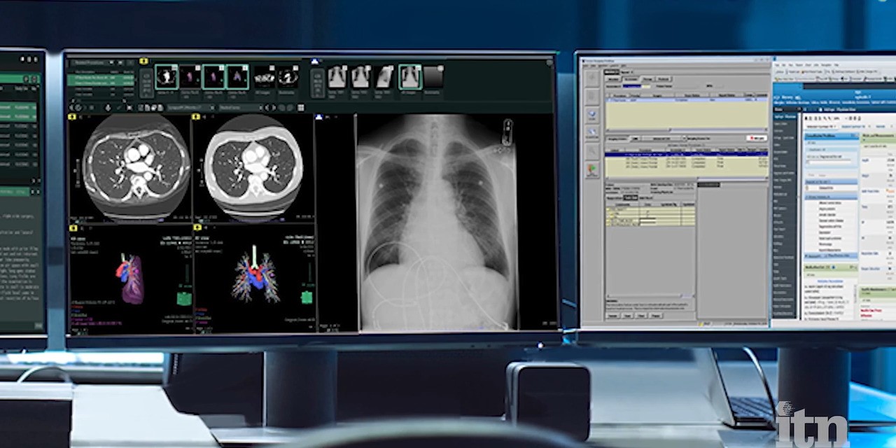 Best RIS PACS Software for Hospitals in Dubai